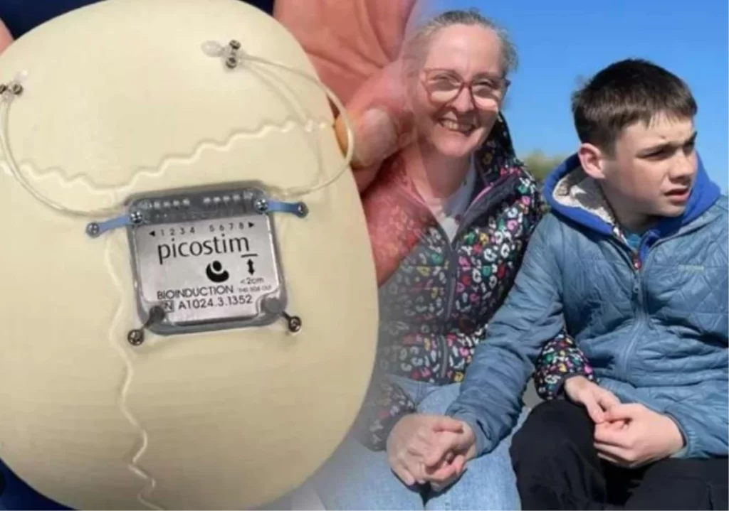 Dünyanın ilk epilepsi cihazı İngiltere'deki bir çocuğun kafatasına ...